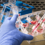 Fulcrum Therapeutics Shares Climb After Q1 Earnings Outperform Expectations